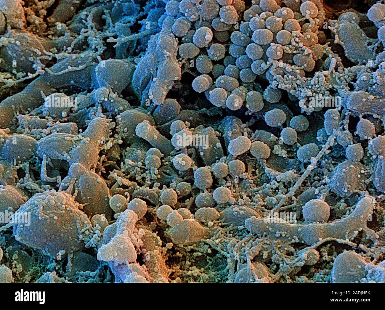 Tooth plaque. Coloured scanning electron micrograph (SEM) of dental ...