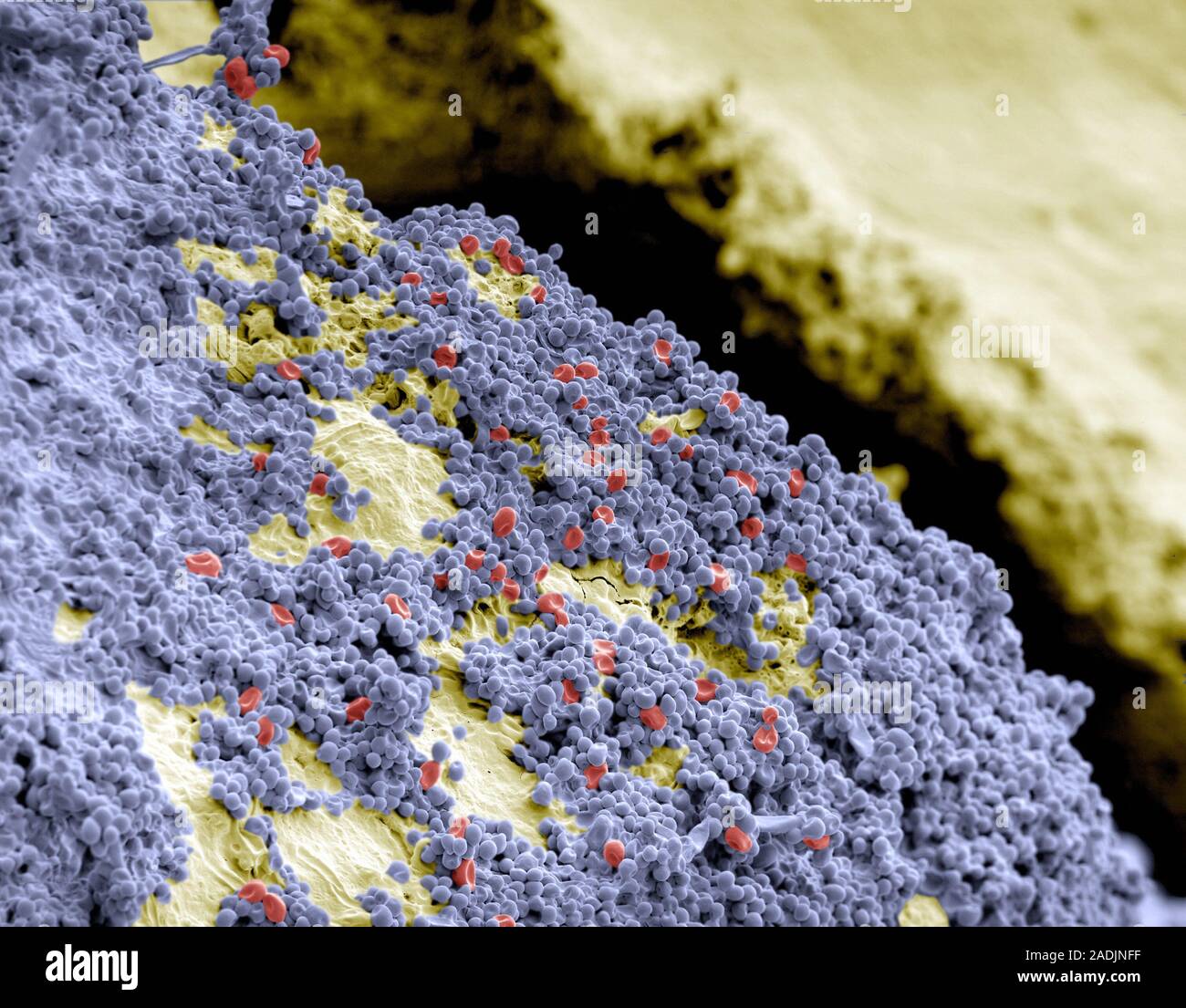 Tooth surface. Coloured scanning electron micrograph (SEM) of the ...