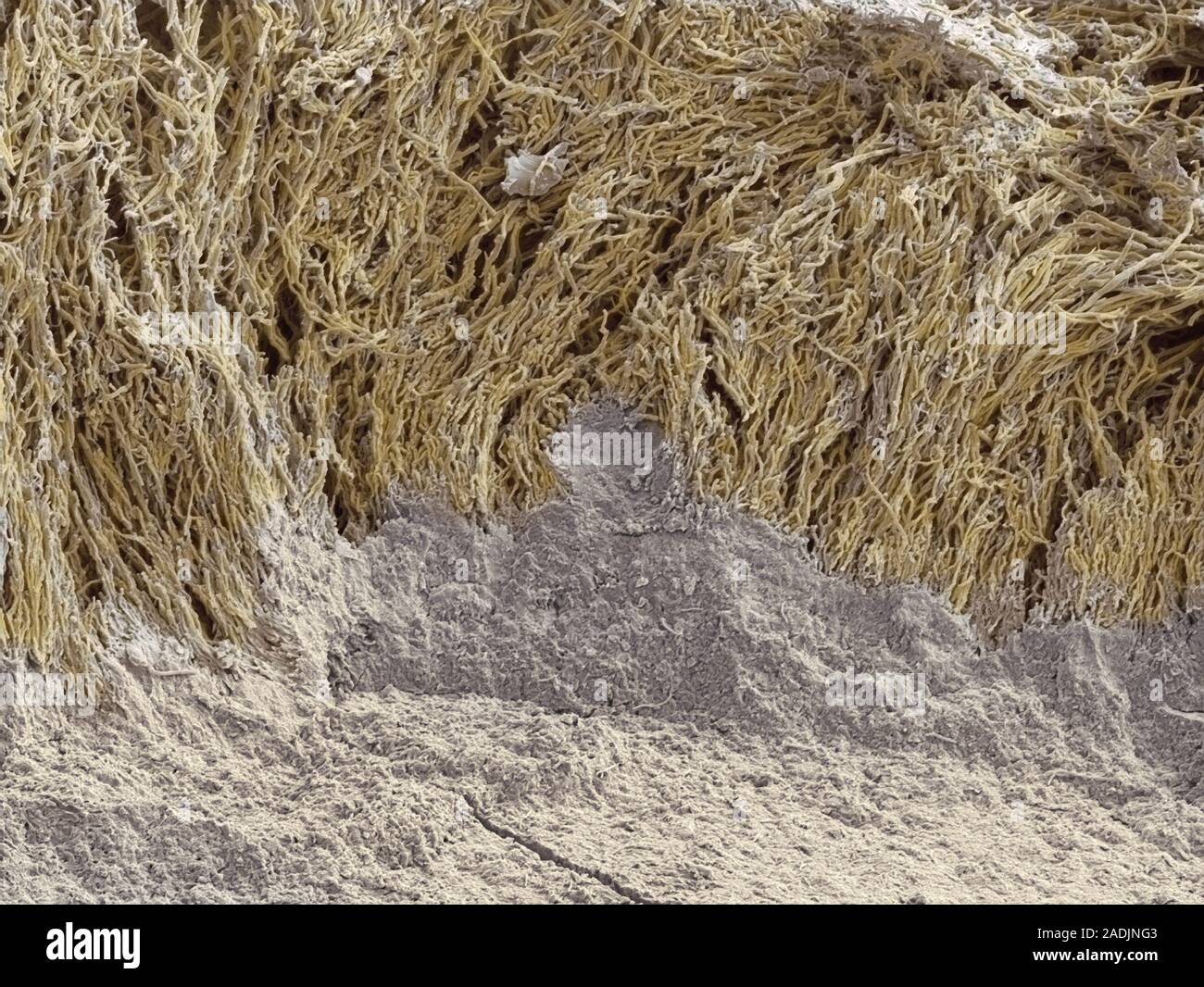 Dental plaque. Coloured scanning electron micrograph (SEM) of a ...