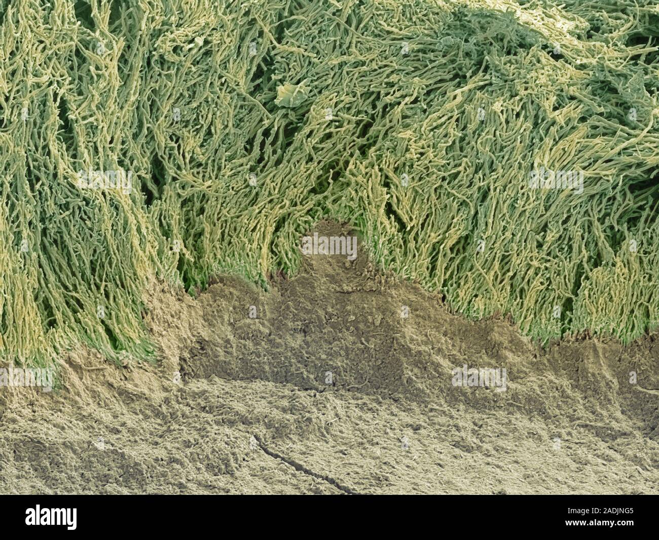 Dental plaque. Coloured scanning electron micrograph (SEM) of a ...