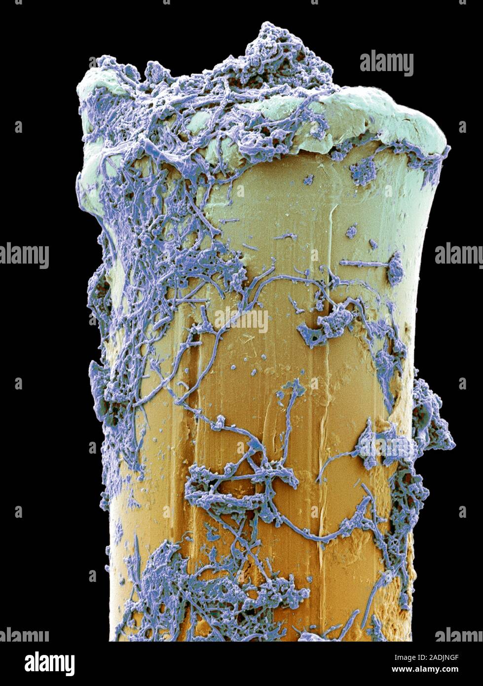 Used toothbrush bristle. Coloured scanning electron micrograph (SEM) of ...