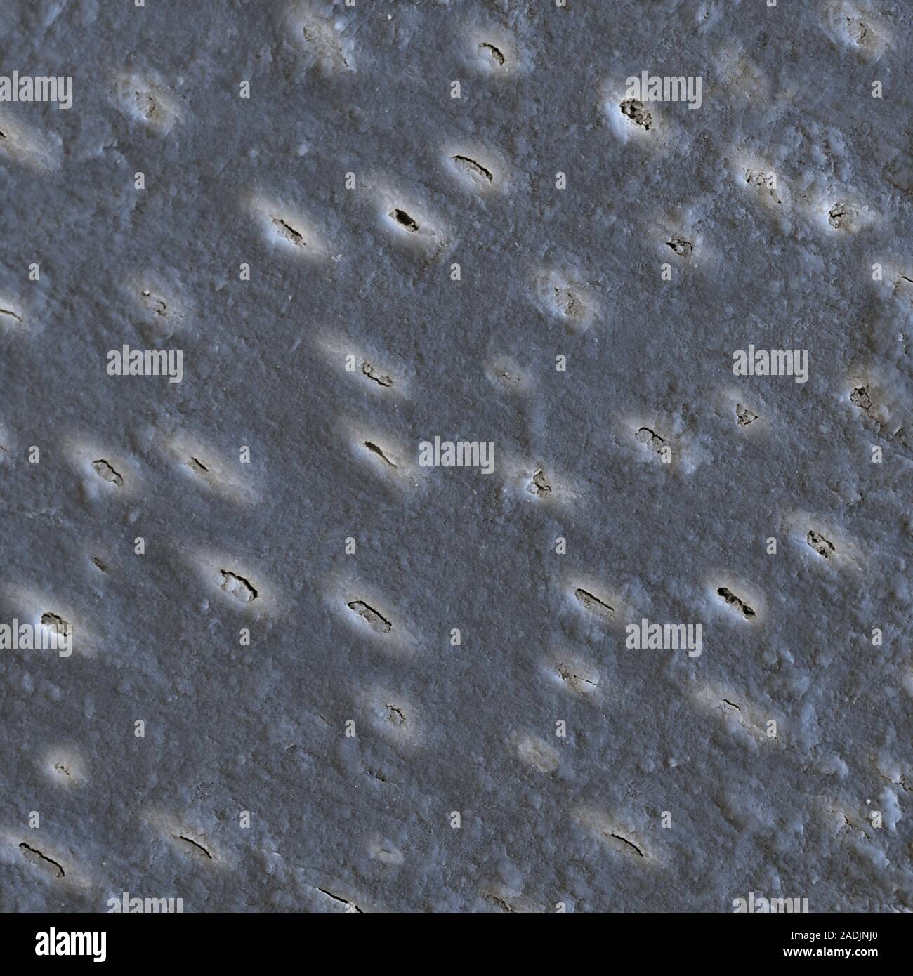 Sensitive tooth after treatment. Coloured scanning electron micrograph ...