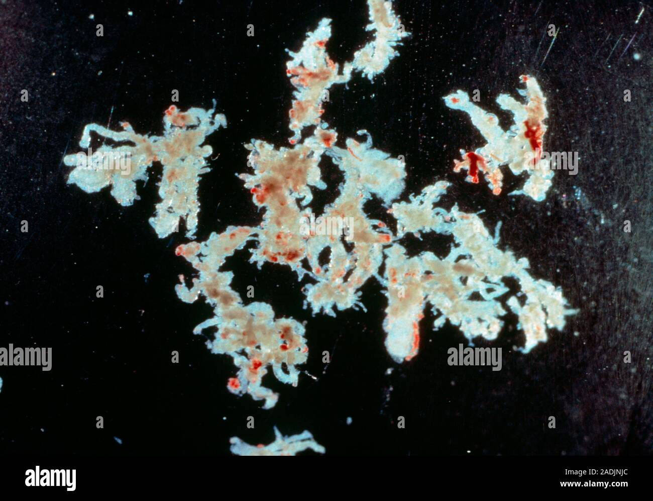 Trophoblast sampling: light micrograph of human trophoblast tissue ...