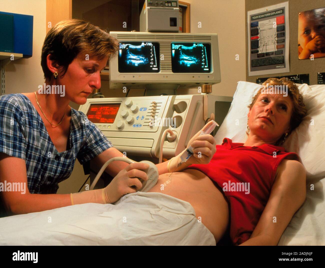 Amniocentesis. Doctor performs an amniocentesis test on a pregnant ...