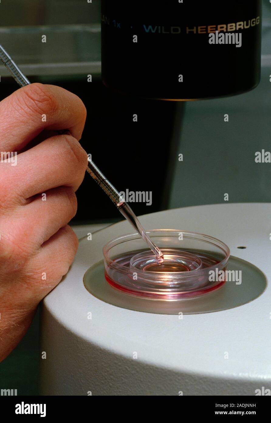 In vitro fertilisation (IVF) technique performed at the IVF unit ...