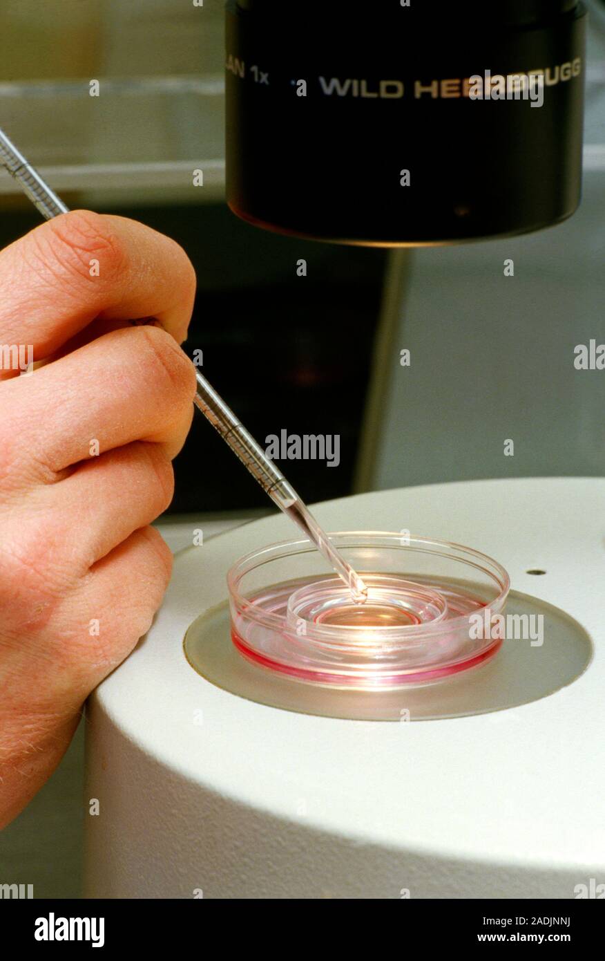 In vitro fertilisation (IVF) technique performed at the IVF unit ...