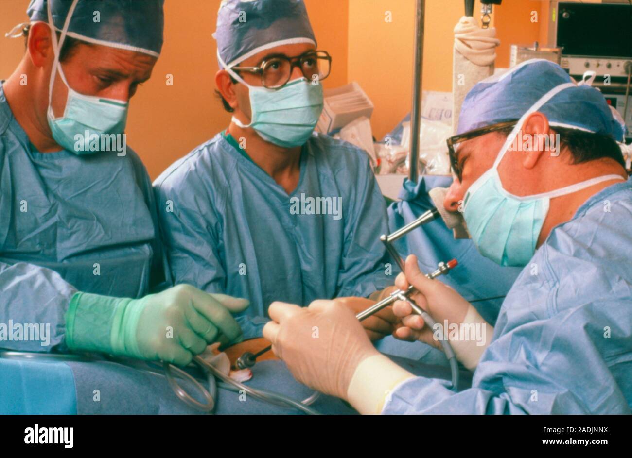 Surgeons performing surgery to harvest a woman's ova for in vitro ...