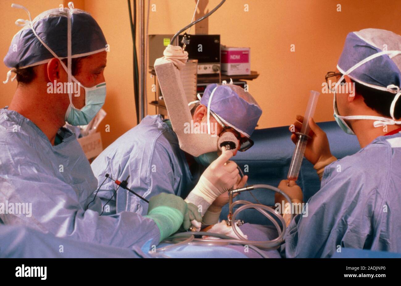 Surgeons performing surgery to harvest a woman's ova for in vitro ...