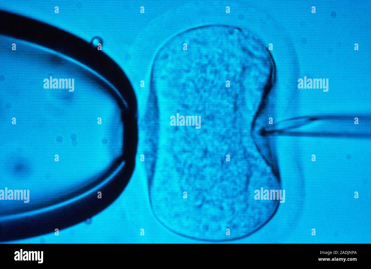 In vitro fertilisation (IVF) research: light microscope image showing a ...