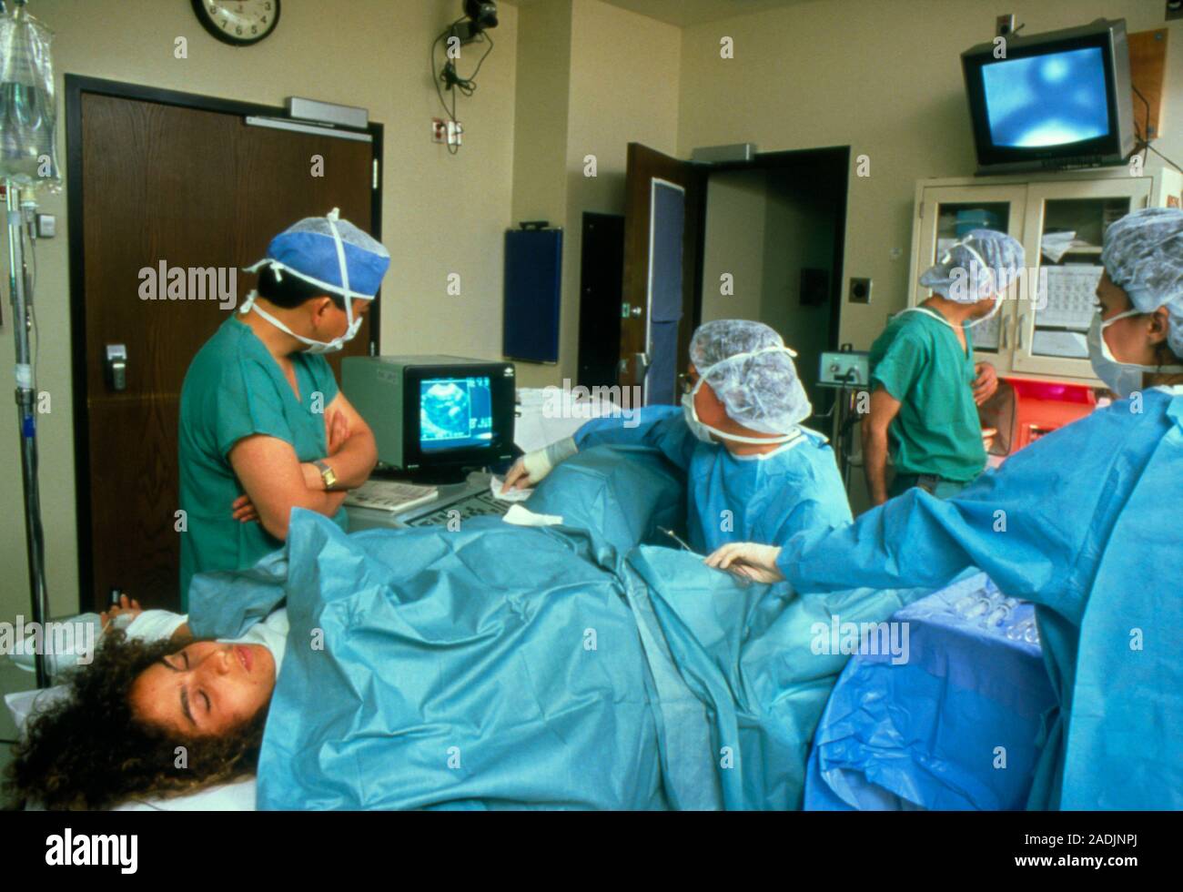 In vitro fertilisation (IVF): surgeon removing eggs from a woman's ...