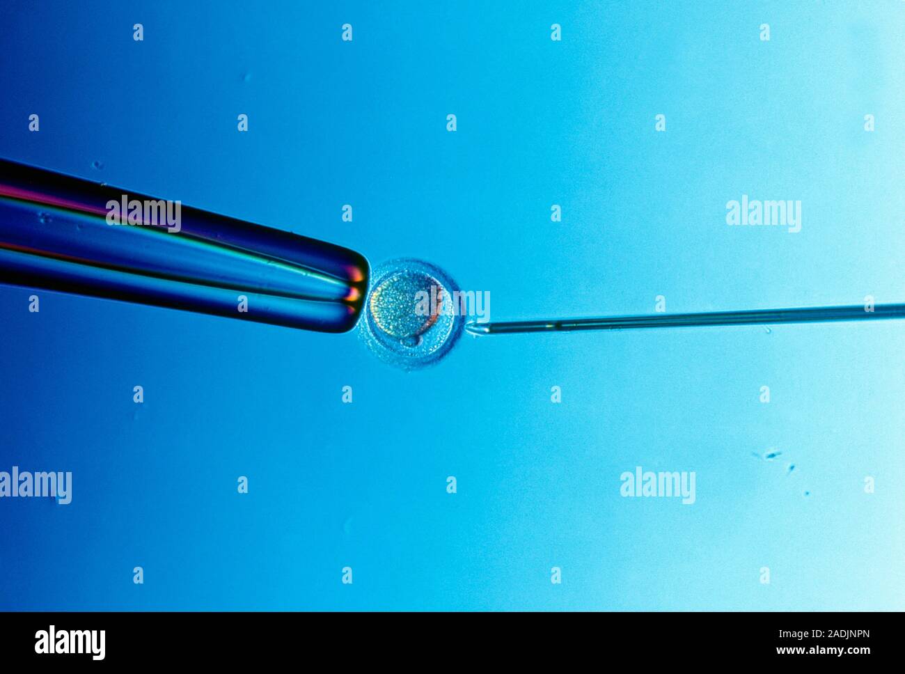In vitro fertilisation. Light microscope view of the process of in ...