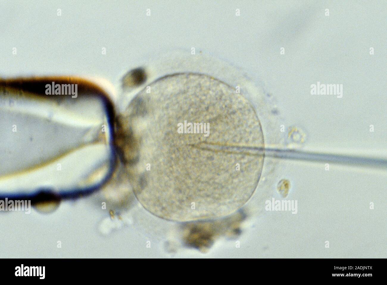 In vitro fertilisation. Light micrograph of a human spermatozoan (sperm ...