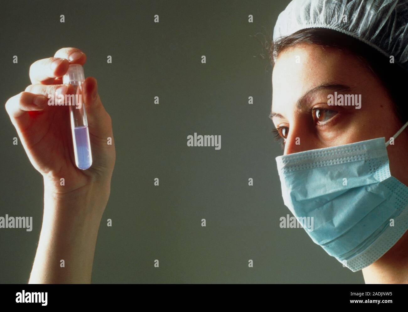 Artificial insemination (image 7 of 9). Woman holds a semen sample ...