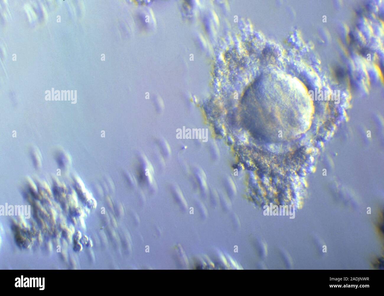 IVF egg preparation. Image 1 of 3. Light micrograph of a human egg cell ...