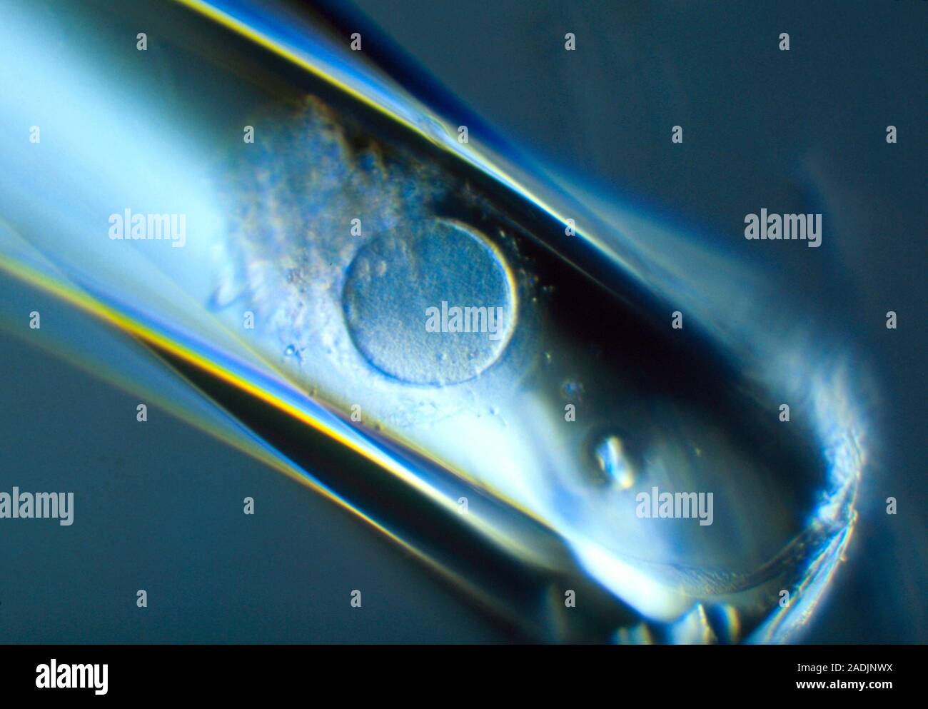 IVF egg preparation. Image 3 of 3. Light micrograph of a human egg cell ...