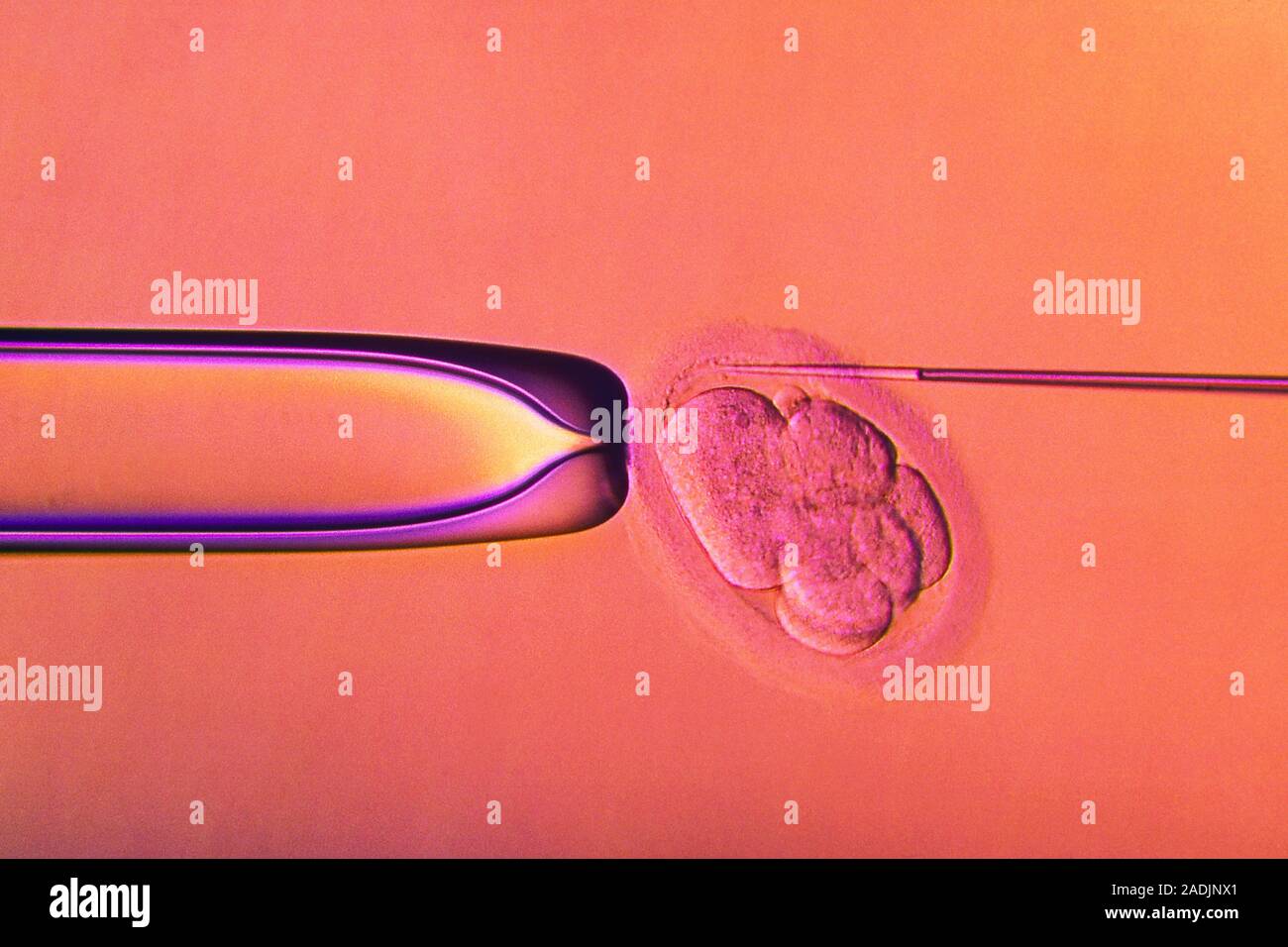 IVF embryo testing (image 2 of 4). Coloured light micrograph of an IVF ...