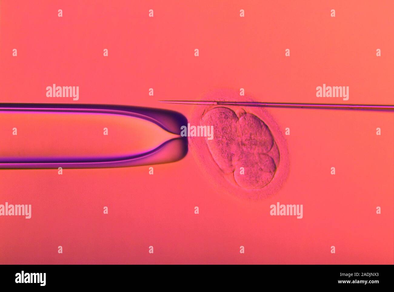 IVF embryo testing (image 3 of 4). Coloured light micrograph of an IVF ...