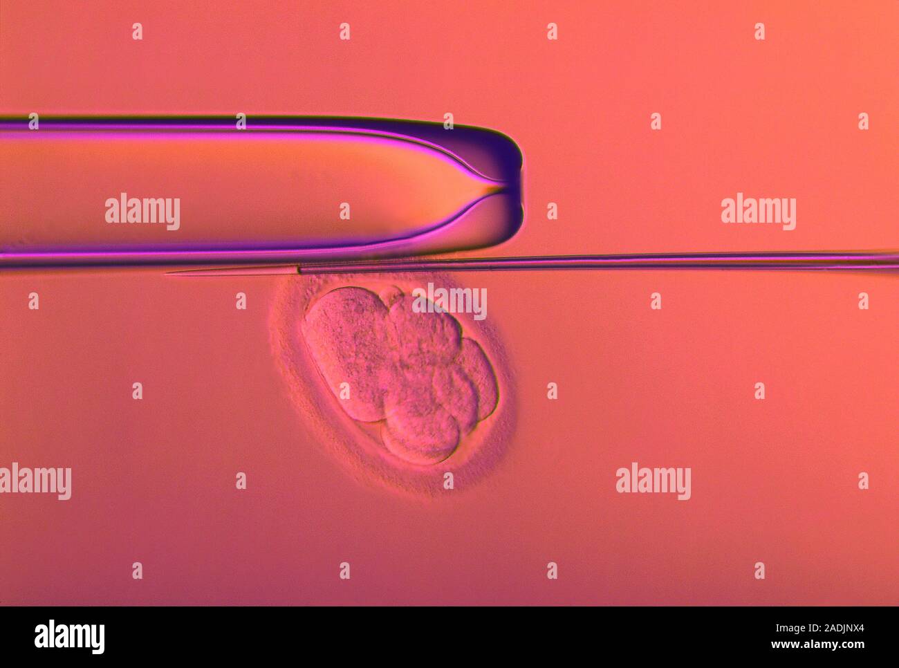 IVF embryo testing (image 4 of 4). Coloured light micrograph of an IVF ...