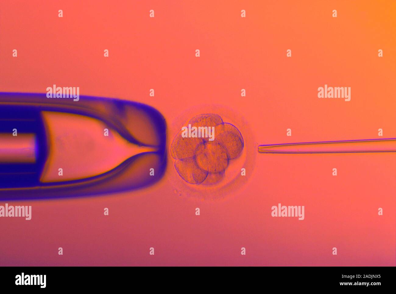 IVF embryo testing (image 1 of 5). Coloured light micrograph of an IVF ...