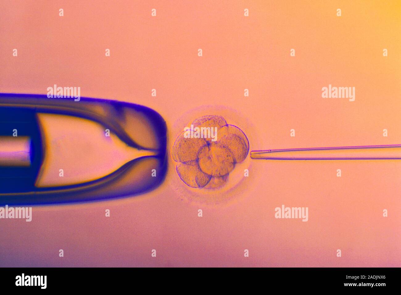 IVF embryo testing (image 2 of 5). Coloured light micrograph of an IVF ...