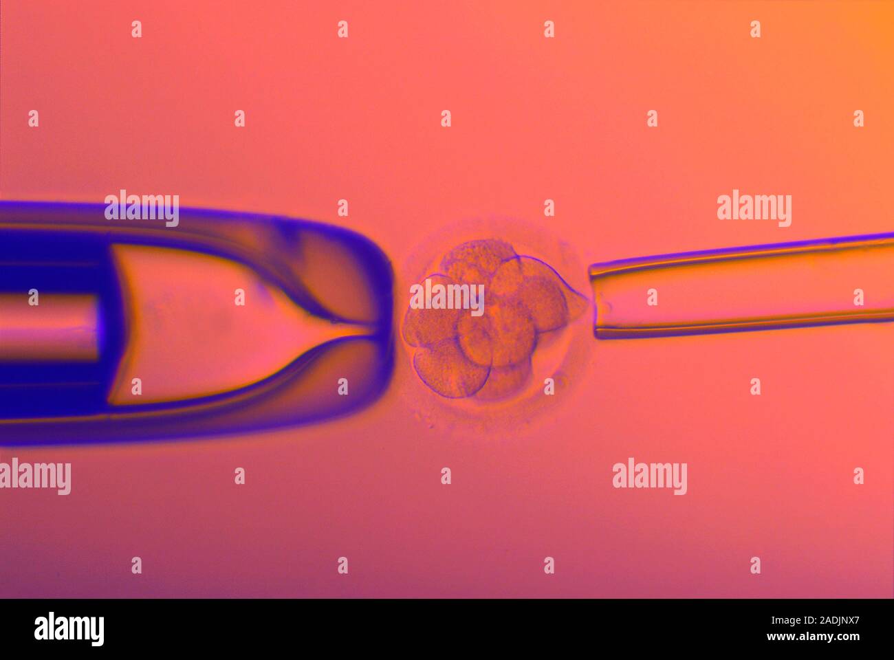 IVF embryo testing (image 3 of 5). Coloured light micrograph of an IVF ...