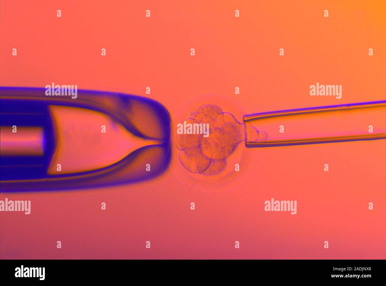 IVF embryo testing (image 4 of 5). Coloured light micrograph of an IVF ...