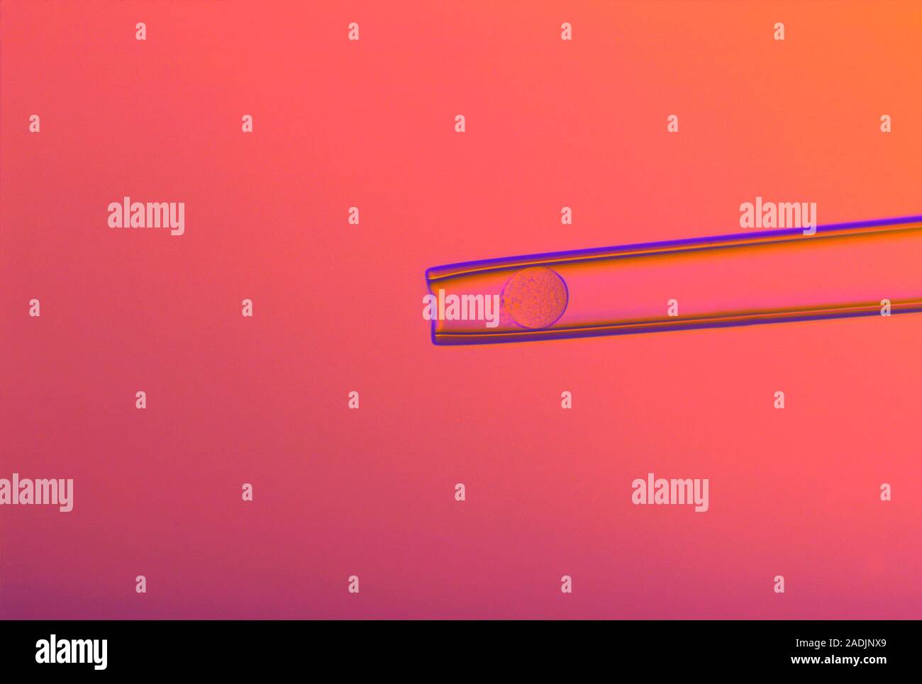 IVF embryo testing (image 5 of 5). Coloured light micrograph of one ...