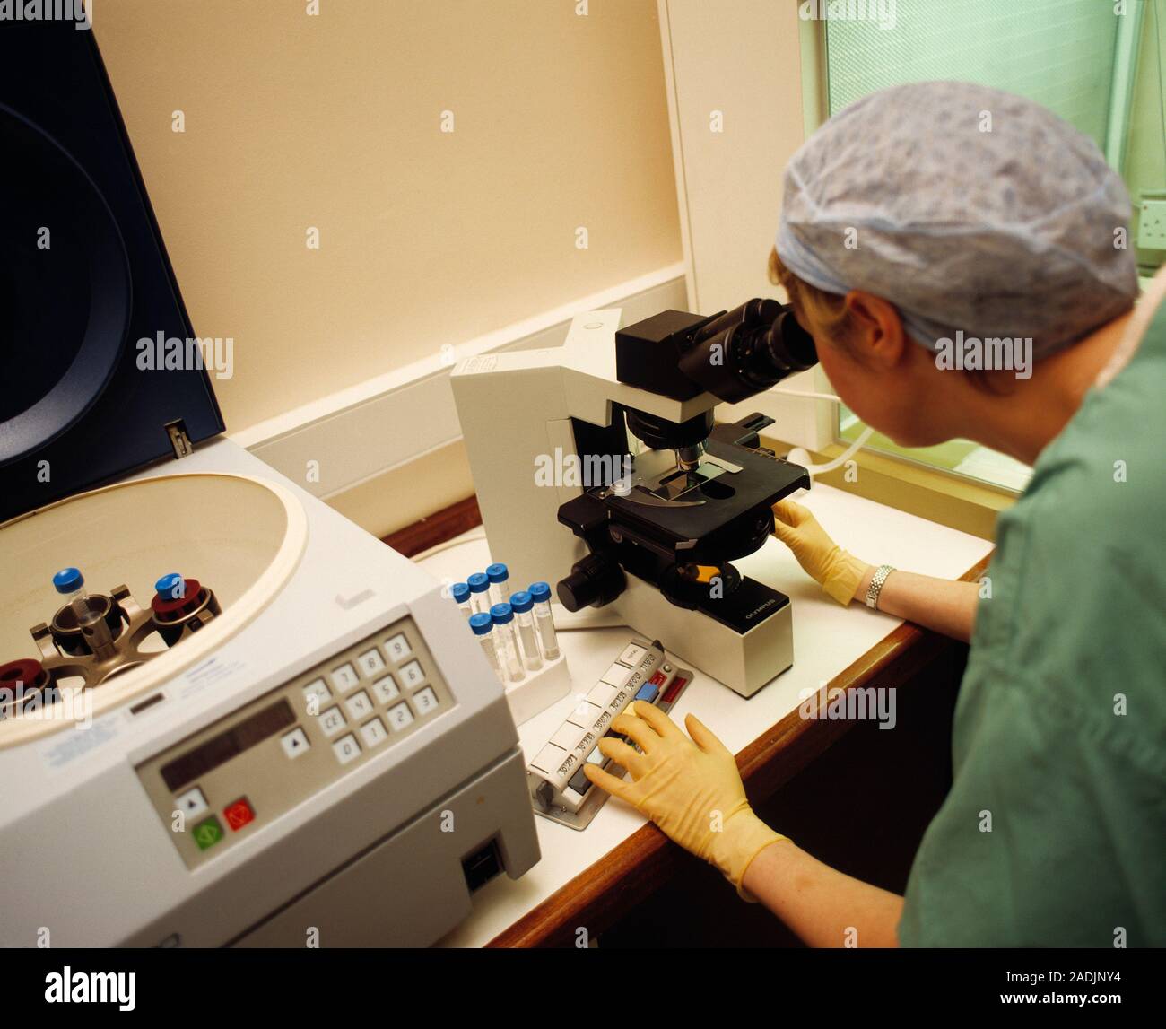 Sperm count for IVF. Technician using a light microscope to count the ...