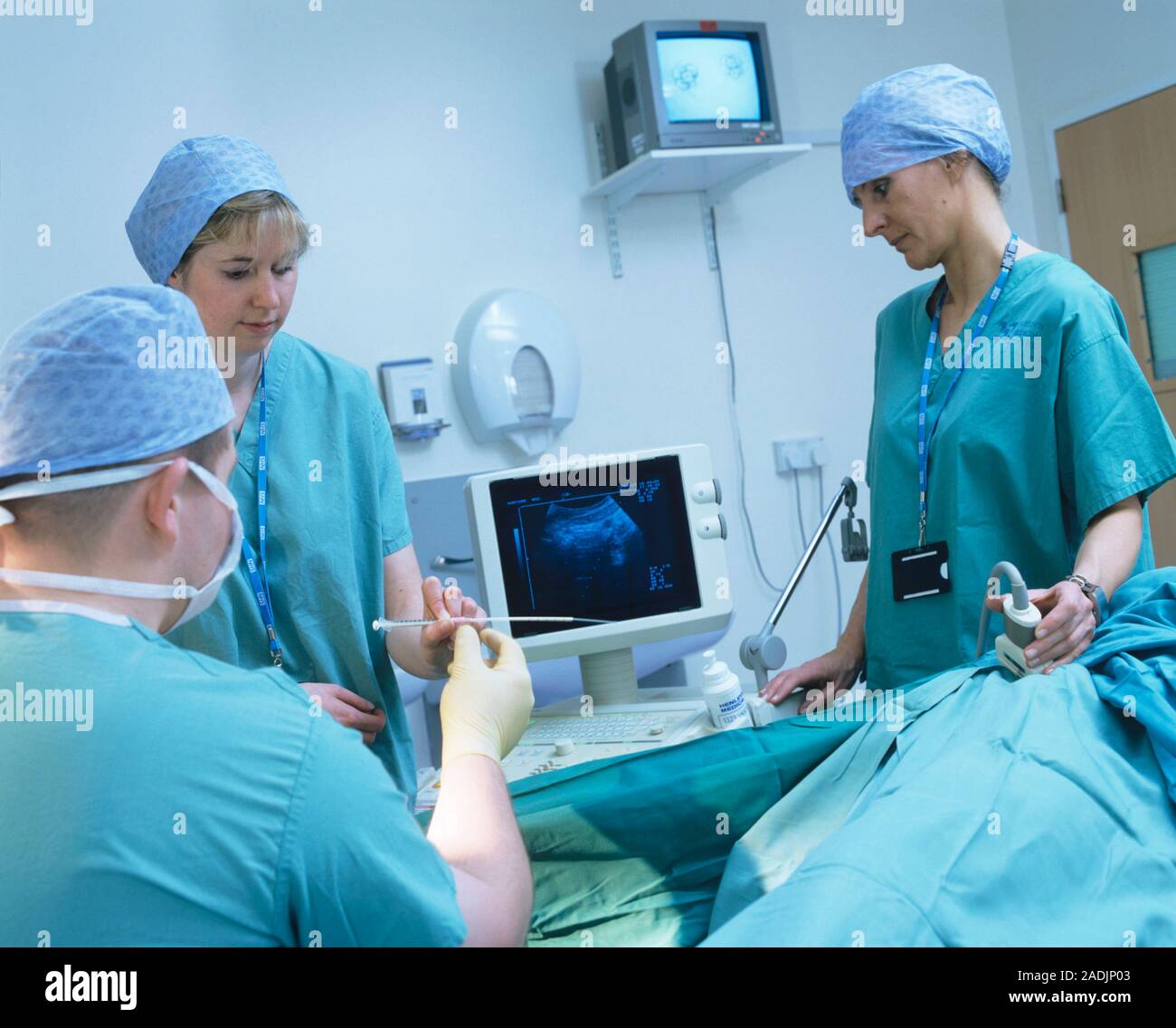 MODEL RELEASED. Embryo transfer. Team of doctors and nurses at an in ...