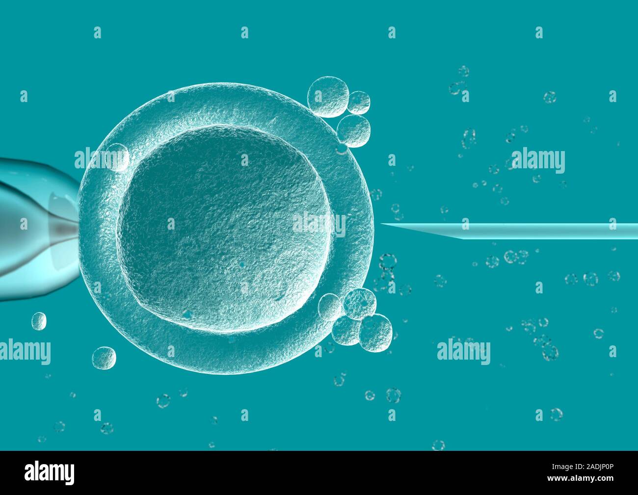 IVF. Computer artwork of a micro-needle about to inject human sperm ...