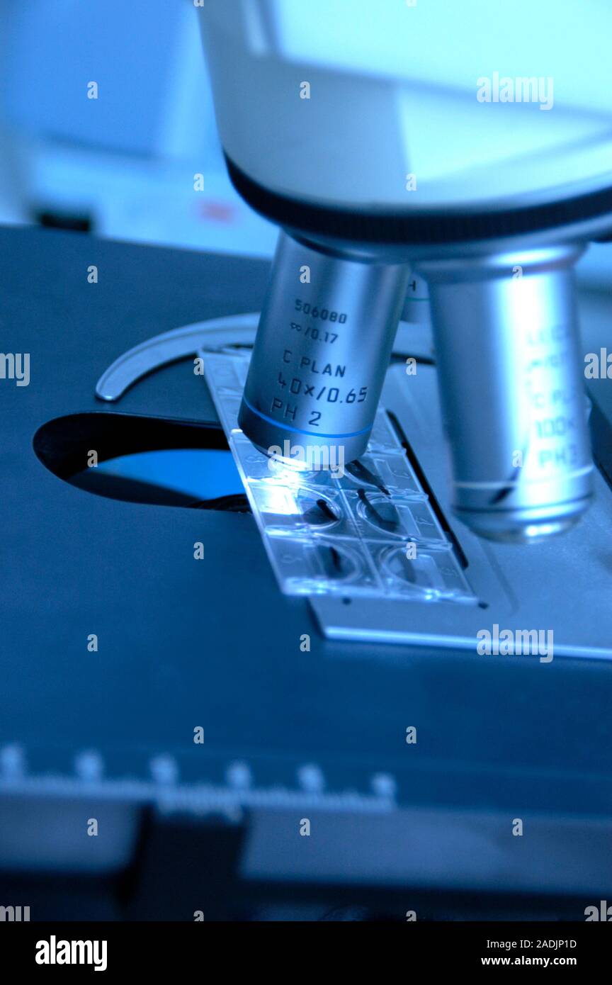 Sperm selection for IVF. Sperm being examined under a microscope to ...