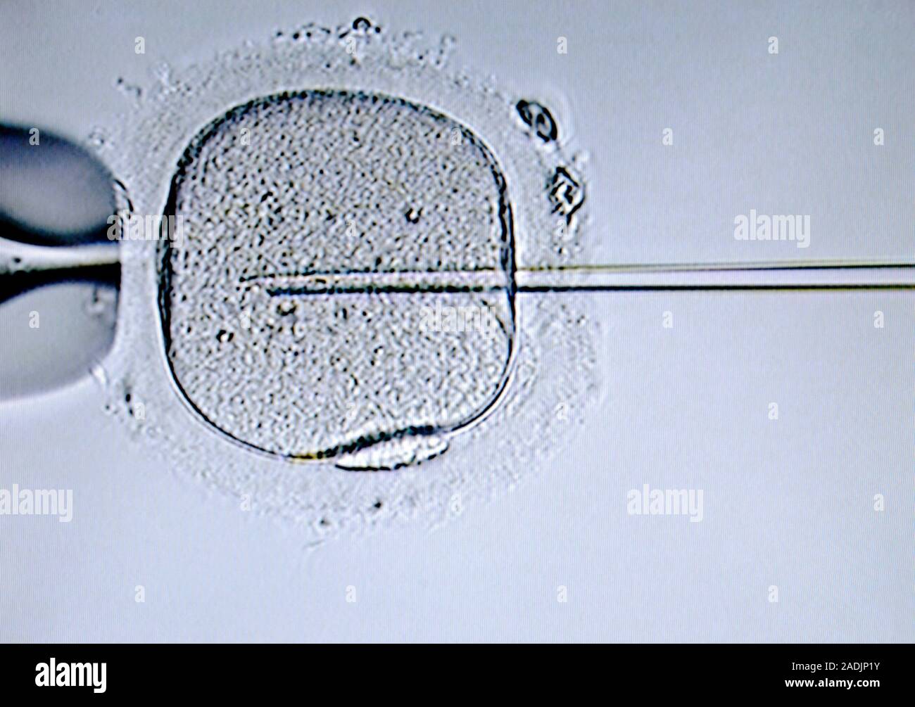 IVF treatment. Light micrograph of a micro-needle (right) injecting ...