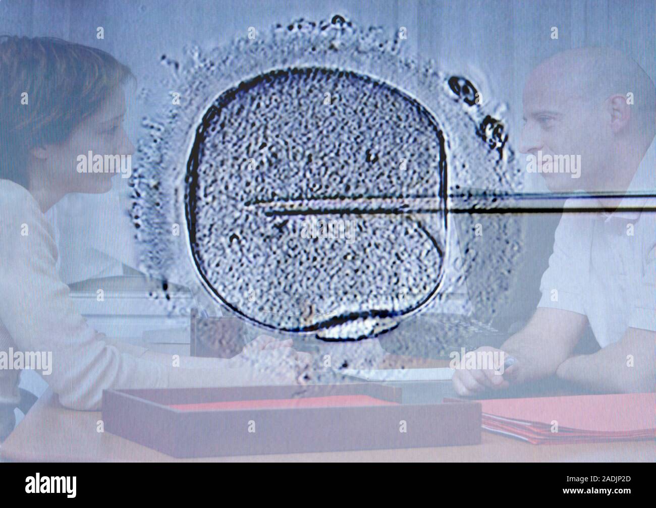 IVF treatment. Light micrograph of a micro-needle (right) injecting ...