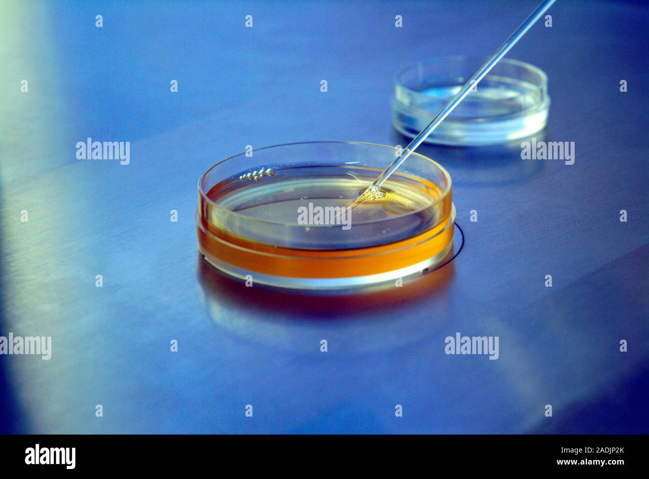 Egg selection for IVF. Harvested ova (eggs) being selected for use in ...