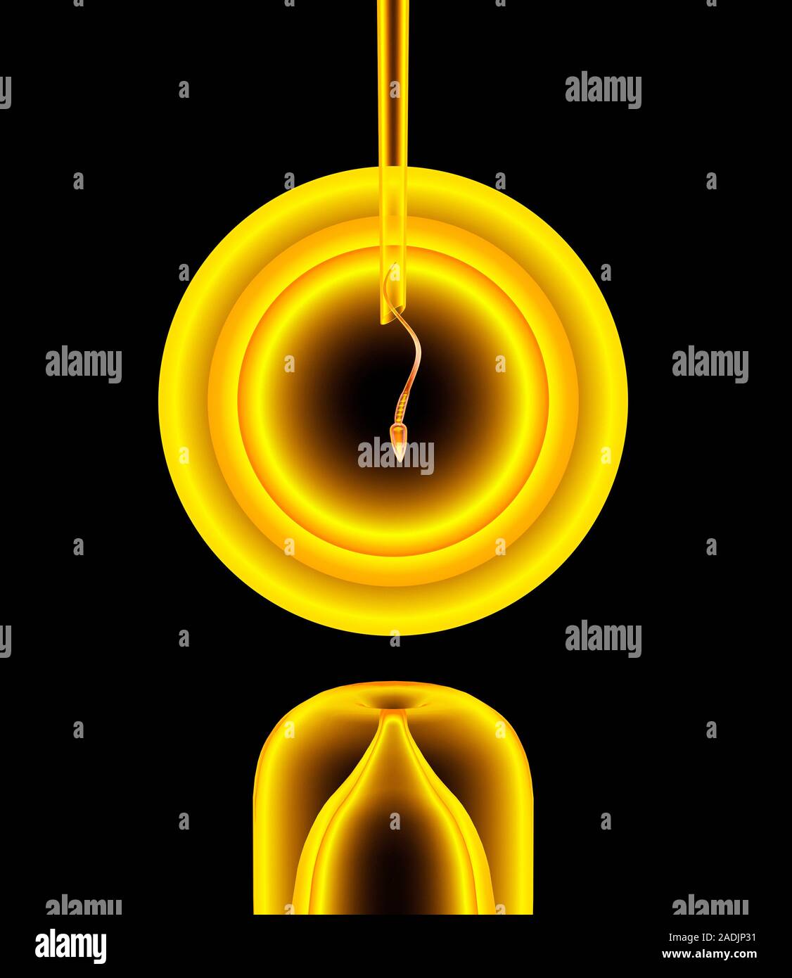 IVF. Conceptual computer artwork depicting a micro-needle injecting a ...