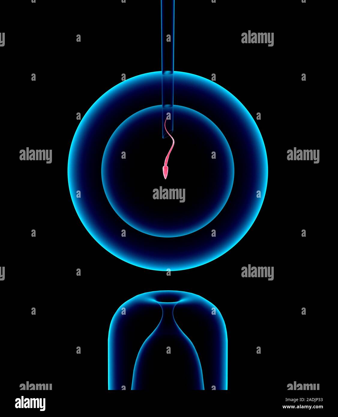 IVF. Conceptual computer artwork depicting a micro-needle injecting a ...