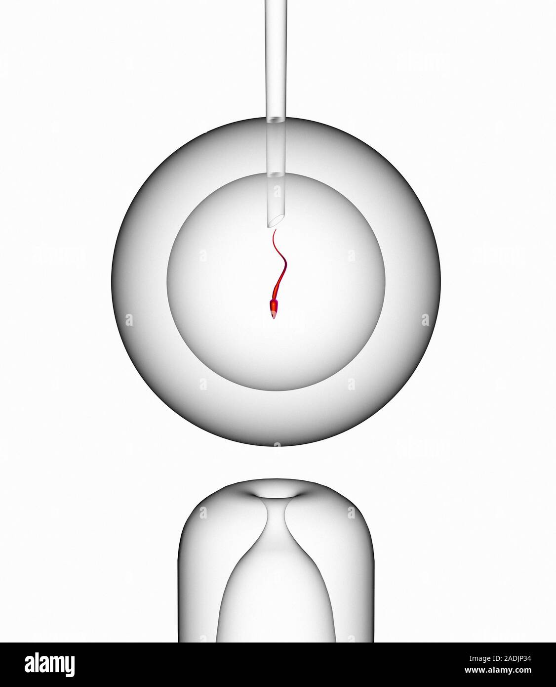 IVF. Conceptual computer artwork depicting a micro-needle injecting a ...