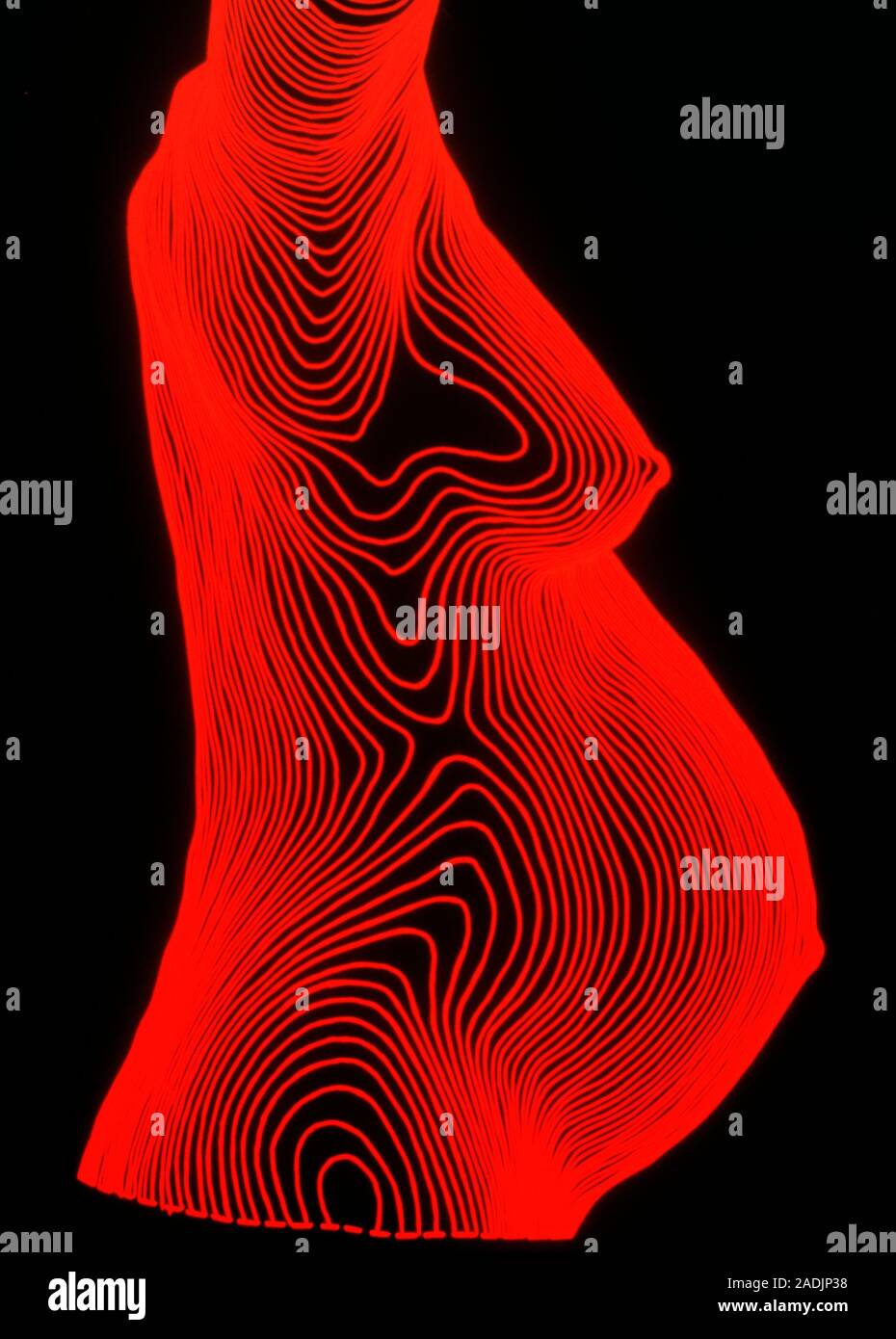 Body contour map of full-term pregnant woman (prima para) lateral view ...