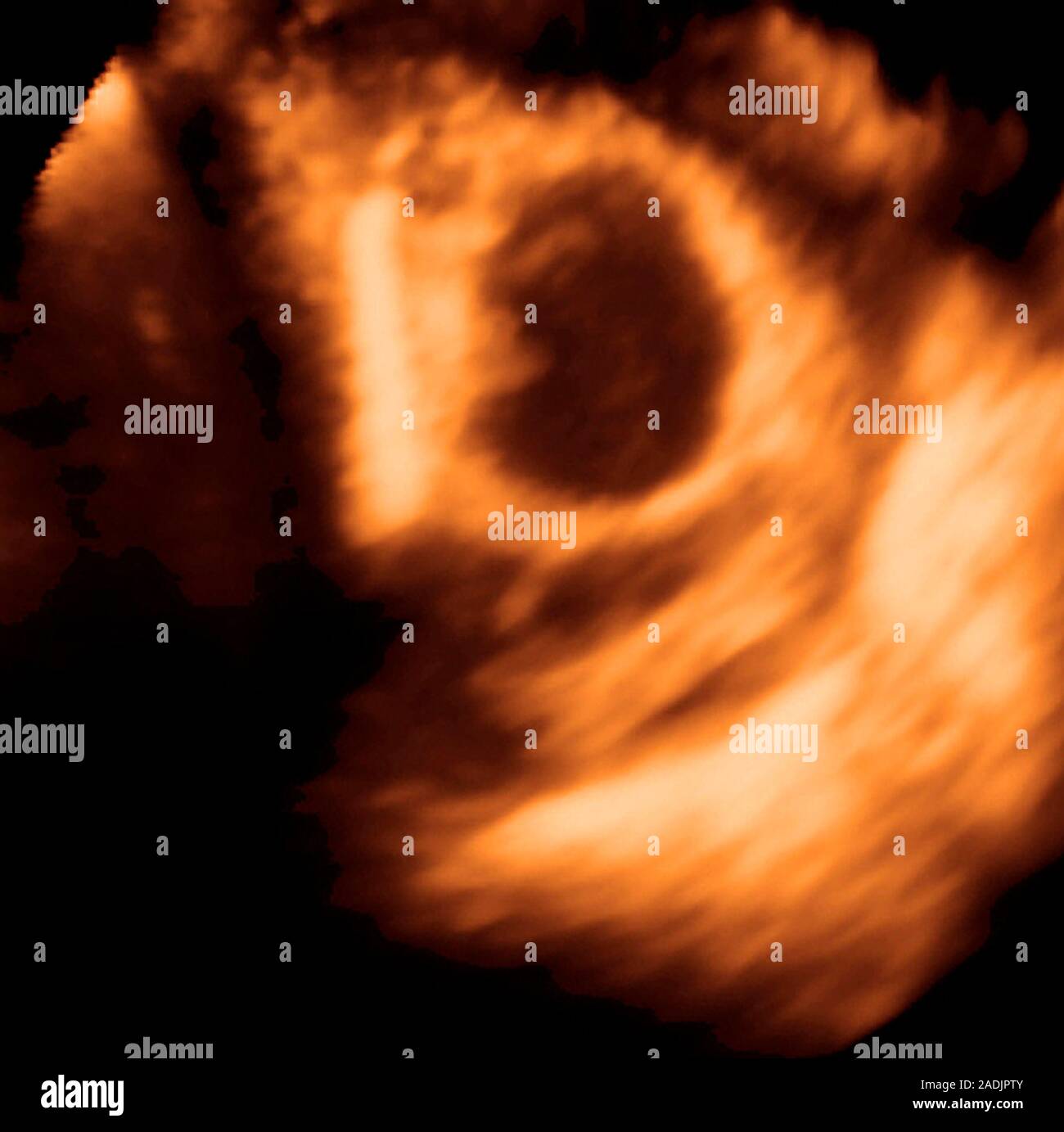 Unplanned pregnancy. Coloured 3-D ultrasound scan of an embryo (brown ...