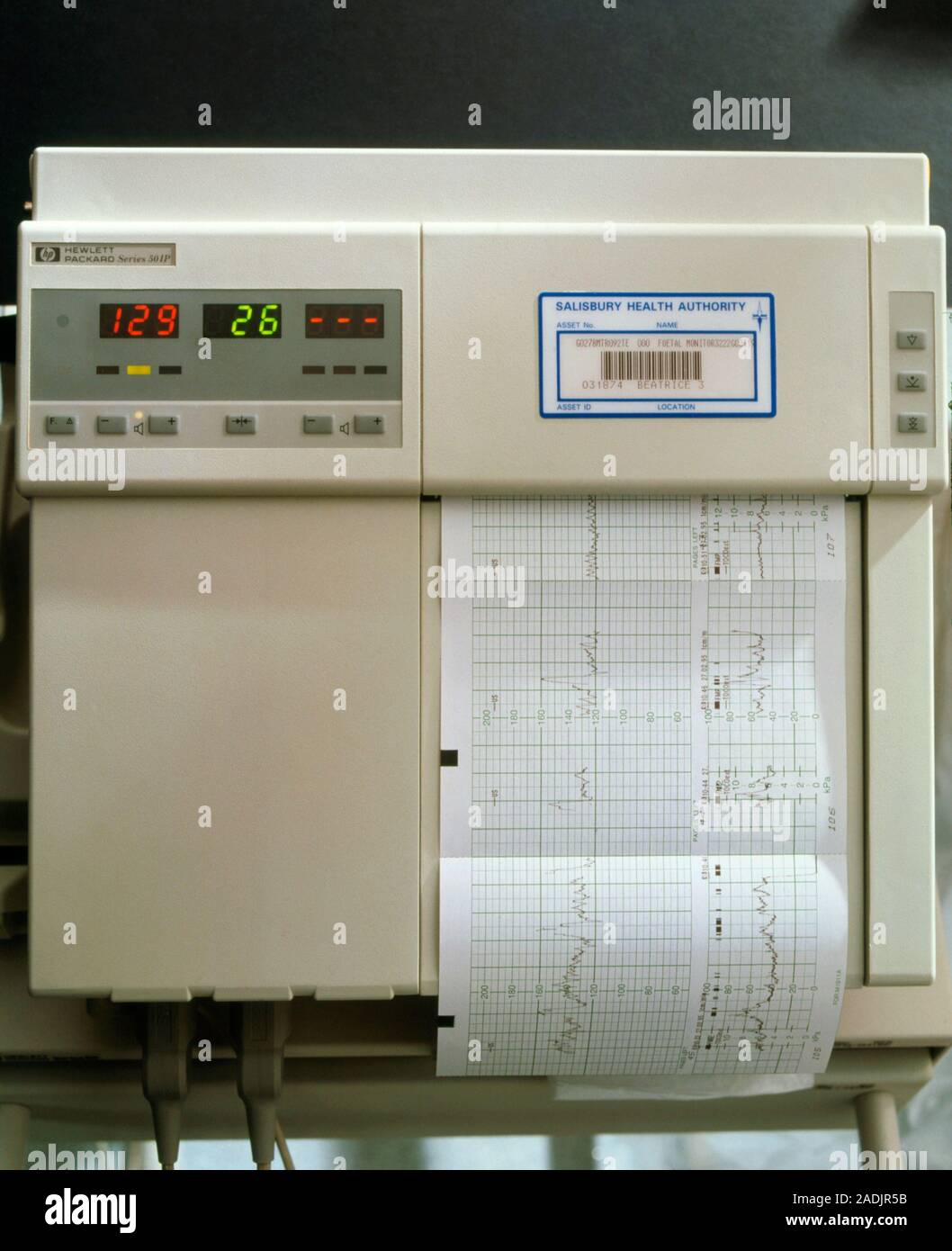 Foetal cardiotocography. View of a cardiotocography (CTG) machine ...