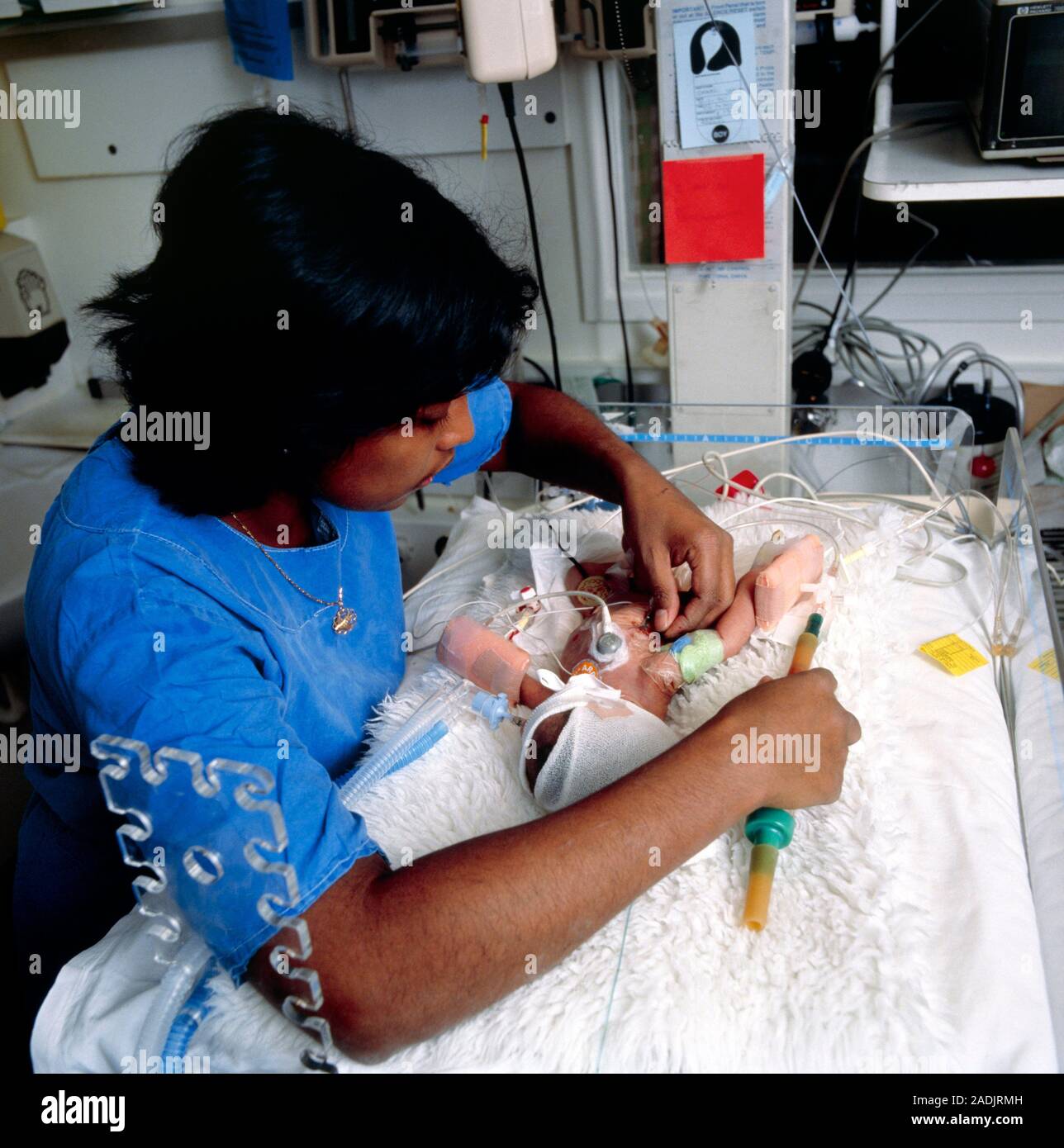 Neonatal infant being attended by a nurse in intensive care Stock Photo ...
