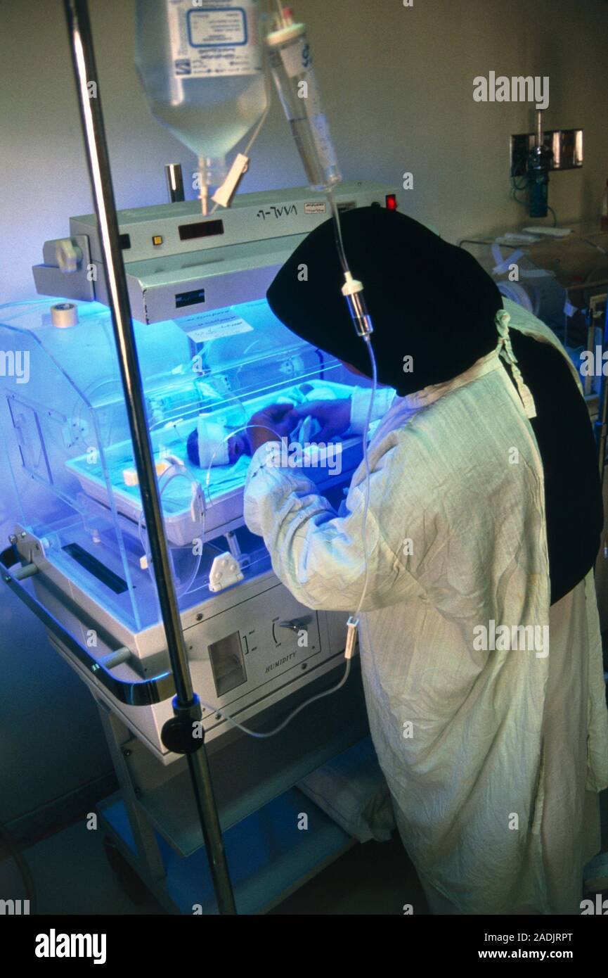 Jaundice baby treatment. Nurse attending to a newborn baby in an ...