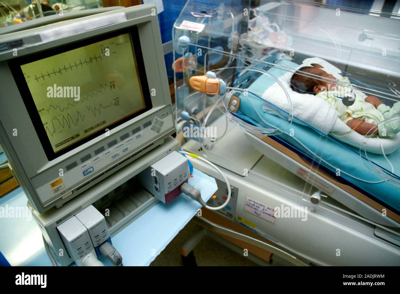 MODEL RELEASED. Premature baby in an incubator attached to a ...