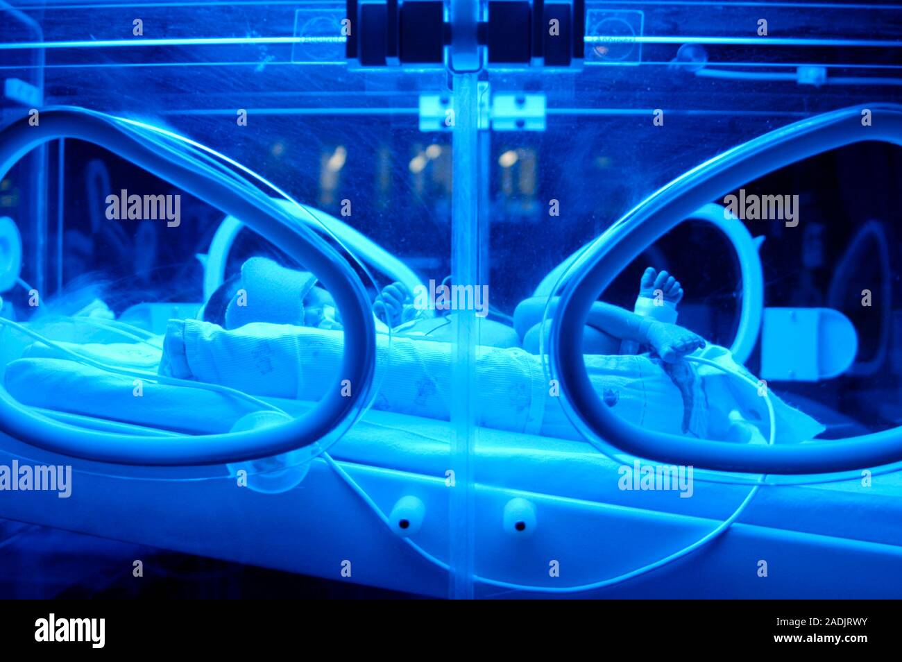 MODEL RELEASED. Phototherapy. Premature baby in an incubator receiving ...