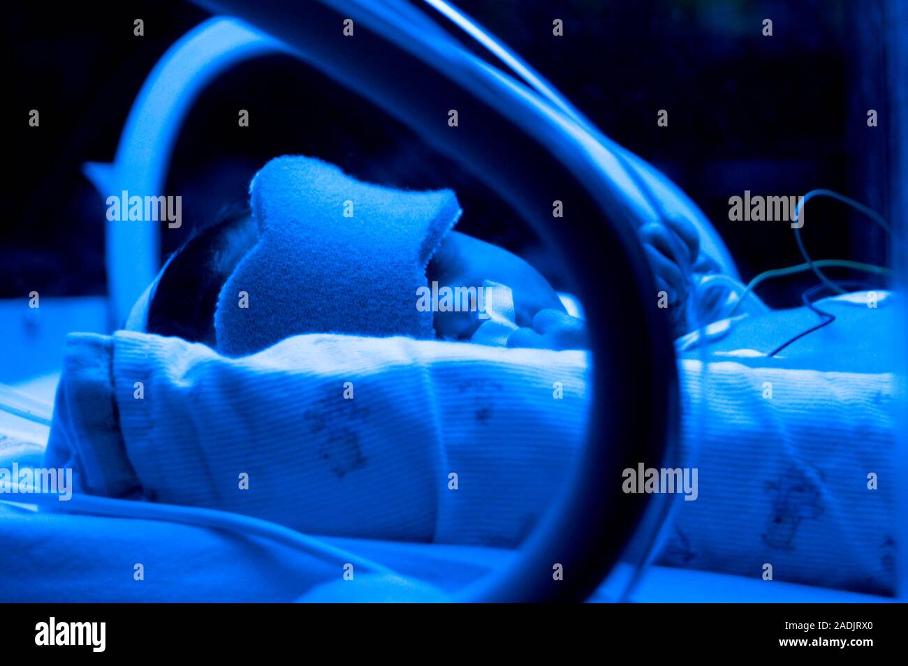 MODEL RELEASED. Phototherapy. Premature baby in an incubator receiving ...
