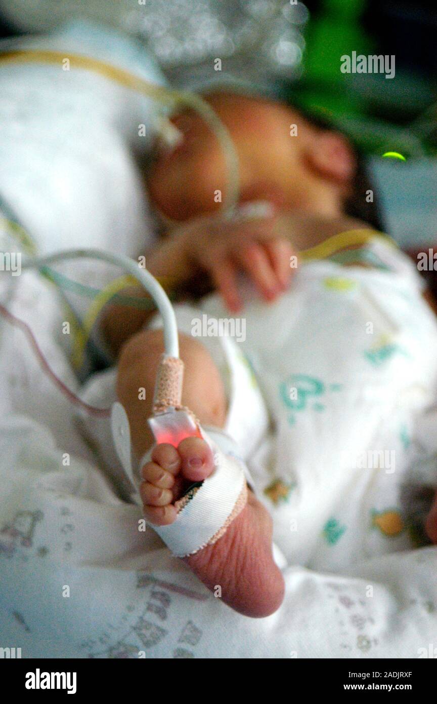 MODEL RELEASED. Oximeter sensor attached to a premature baby's foot ...