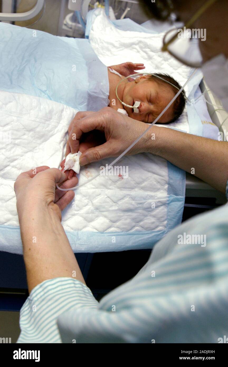 MODEL RELEASED. Nurse inserting a catheter into the hand of a premature ...