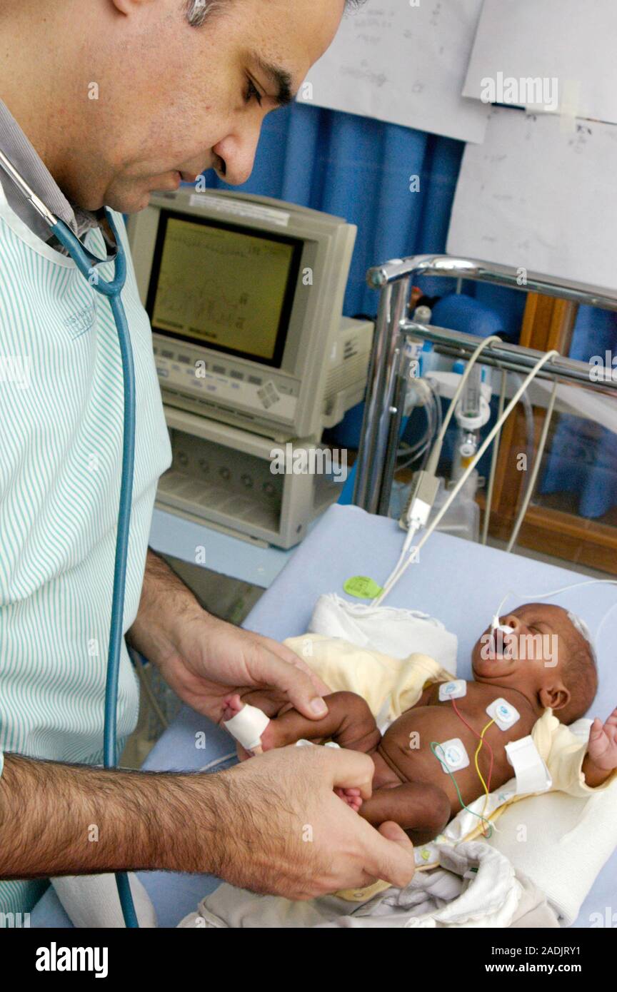 Premature baby. Doctor examining a premature baby. The ...