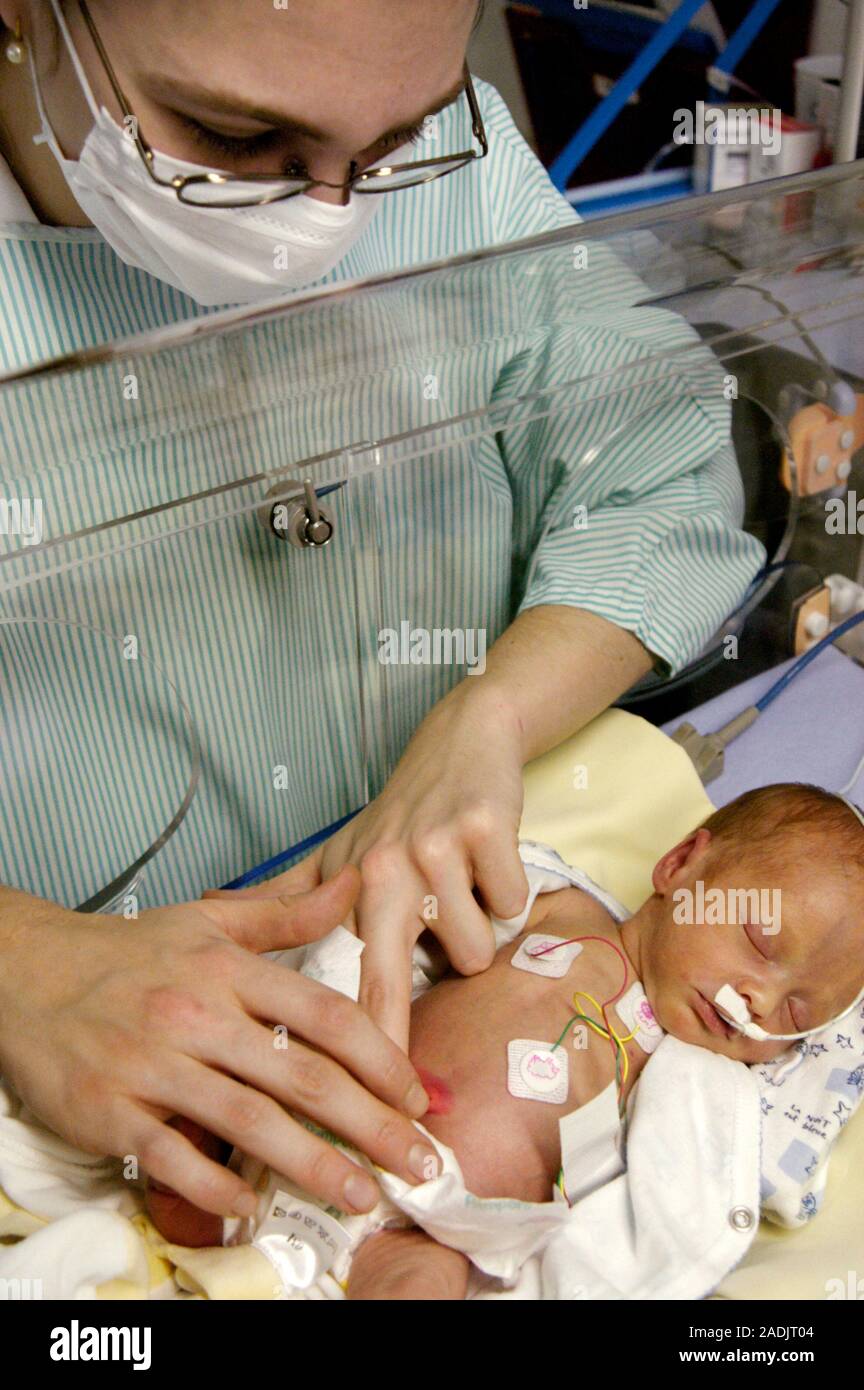 Premature baby. Doctor palpating a premature baby around its umbilical ...
