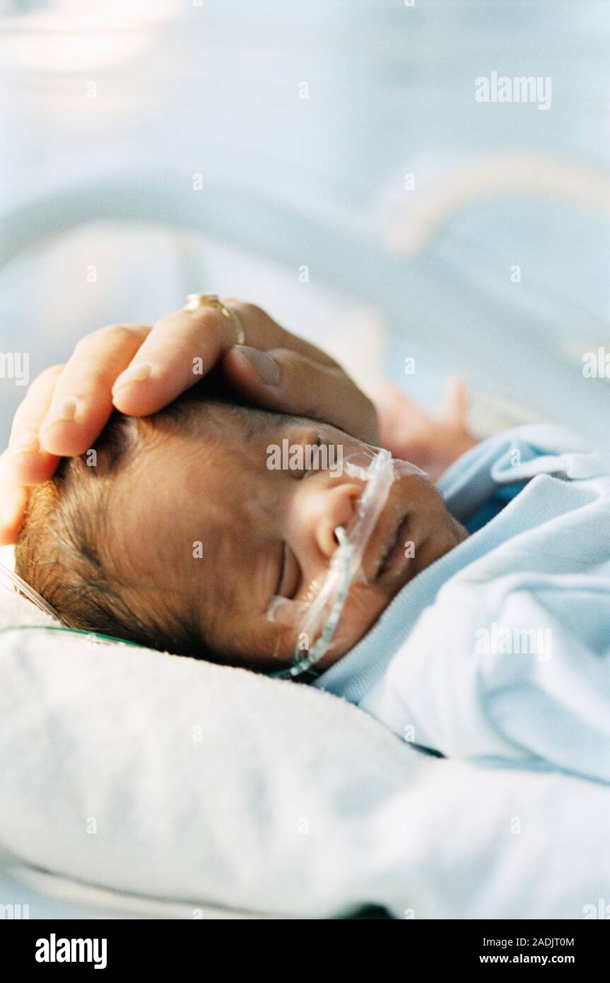 MODEL RELEASED. Premature baby. Hand comforting a premature baby with a ...
